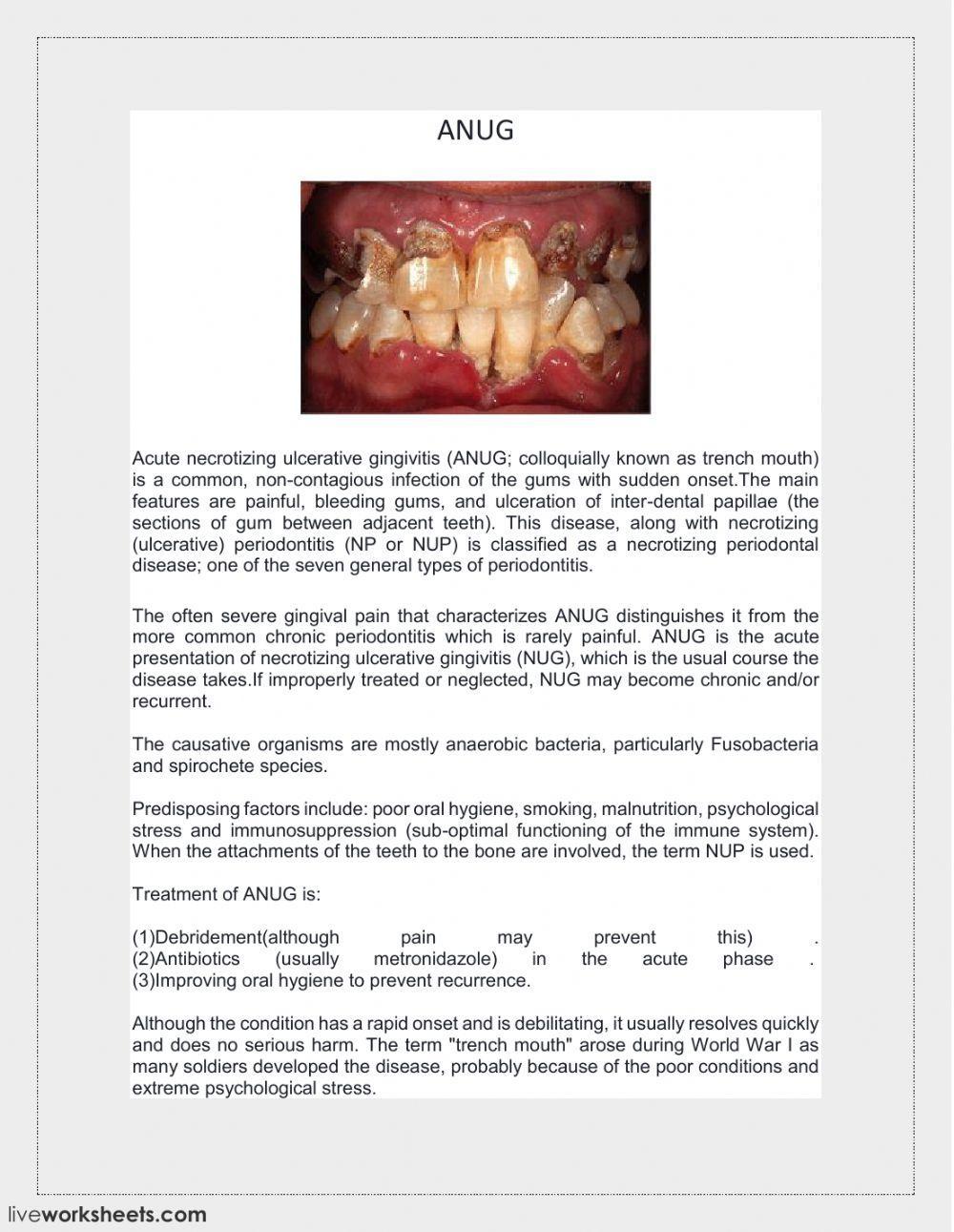 READING COMPREHENSION ANUG 50074 | English time