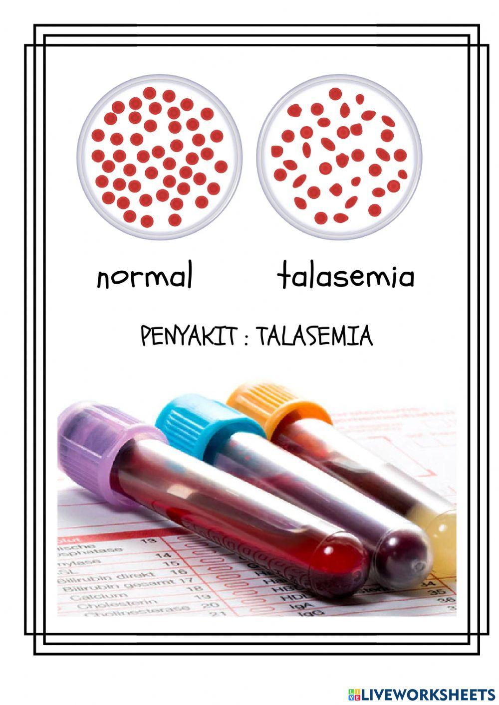 TALASEMIA | Free Interactive Worksheets | 1504089
