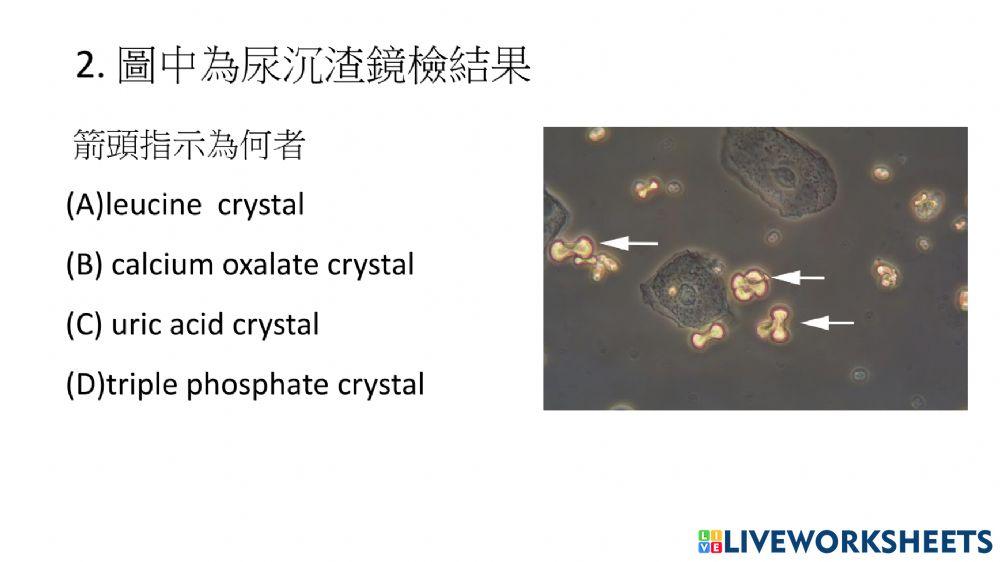 Leucine In Urine Leucine In Urine