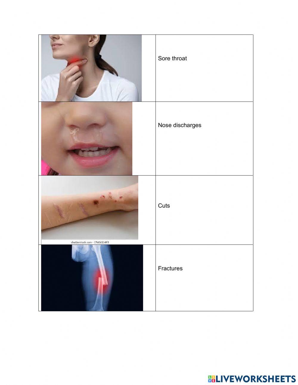 Matching about Symptoms worksheet | Live Worksheets