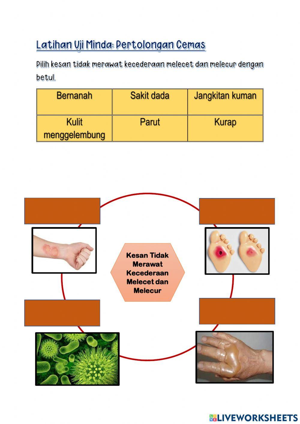 Kesan Tidak Merawat Kecederaan Melecet dan Melecur worksheet | Live ...