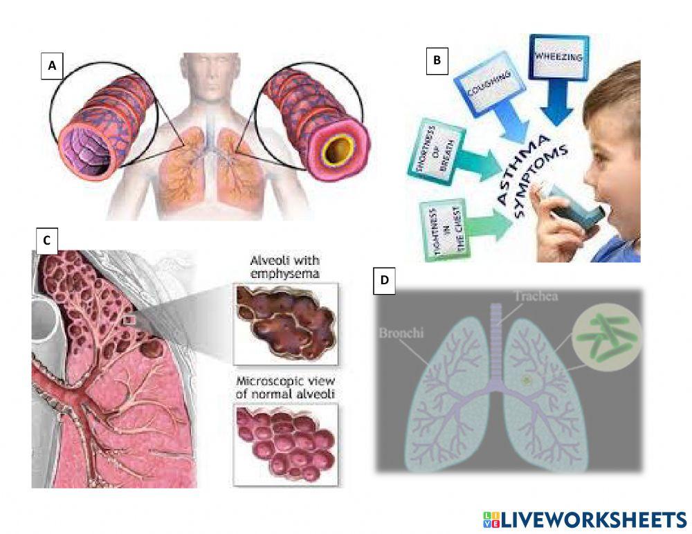 D&D Respiratory worksheet | Live Worksheets