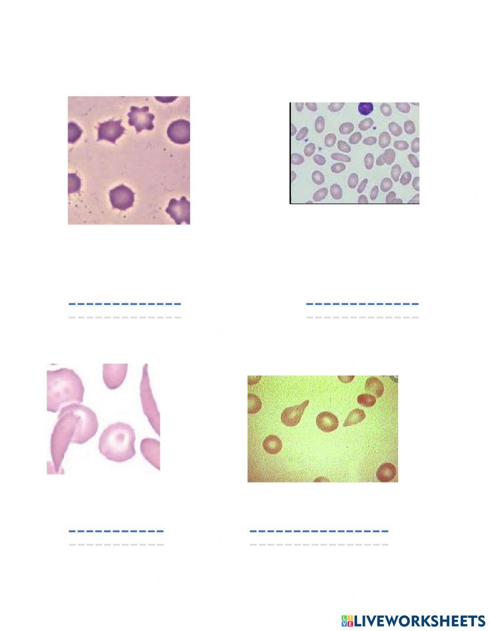 Hematologia worksheet | Live Worksheets