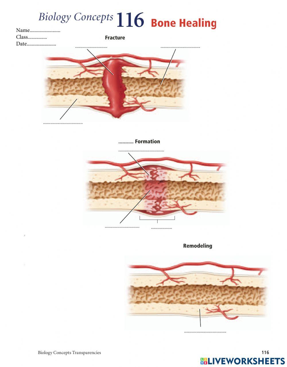 Bone Repair 2824 | sohail626 | Live Worksheets