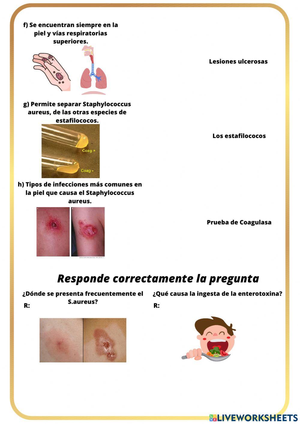 Staphylococcus Aureus online exercise for | Live Worksheets